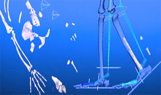 DartmouthX: Bipedalism: The Science of Upright Walking | edX